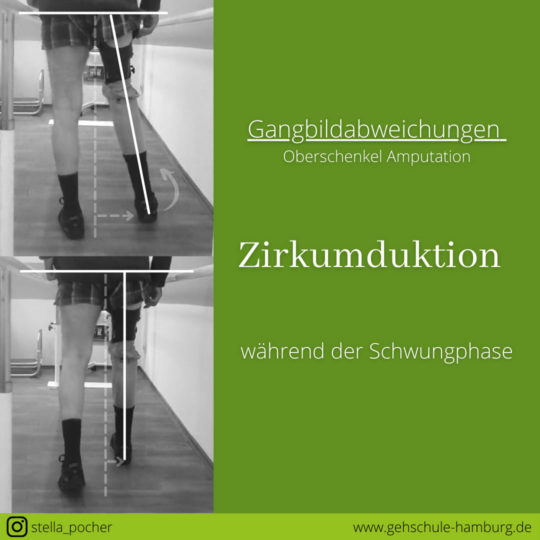 Zirkumduktion - Gehschule Hamburg